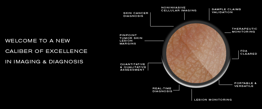 Caliber I.D. - Imaging & Diagnosis on a Cellular Level